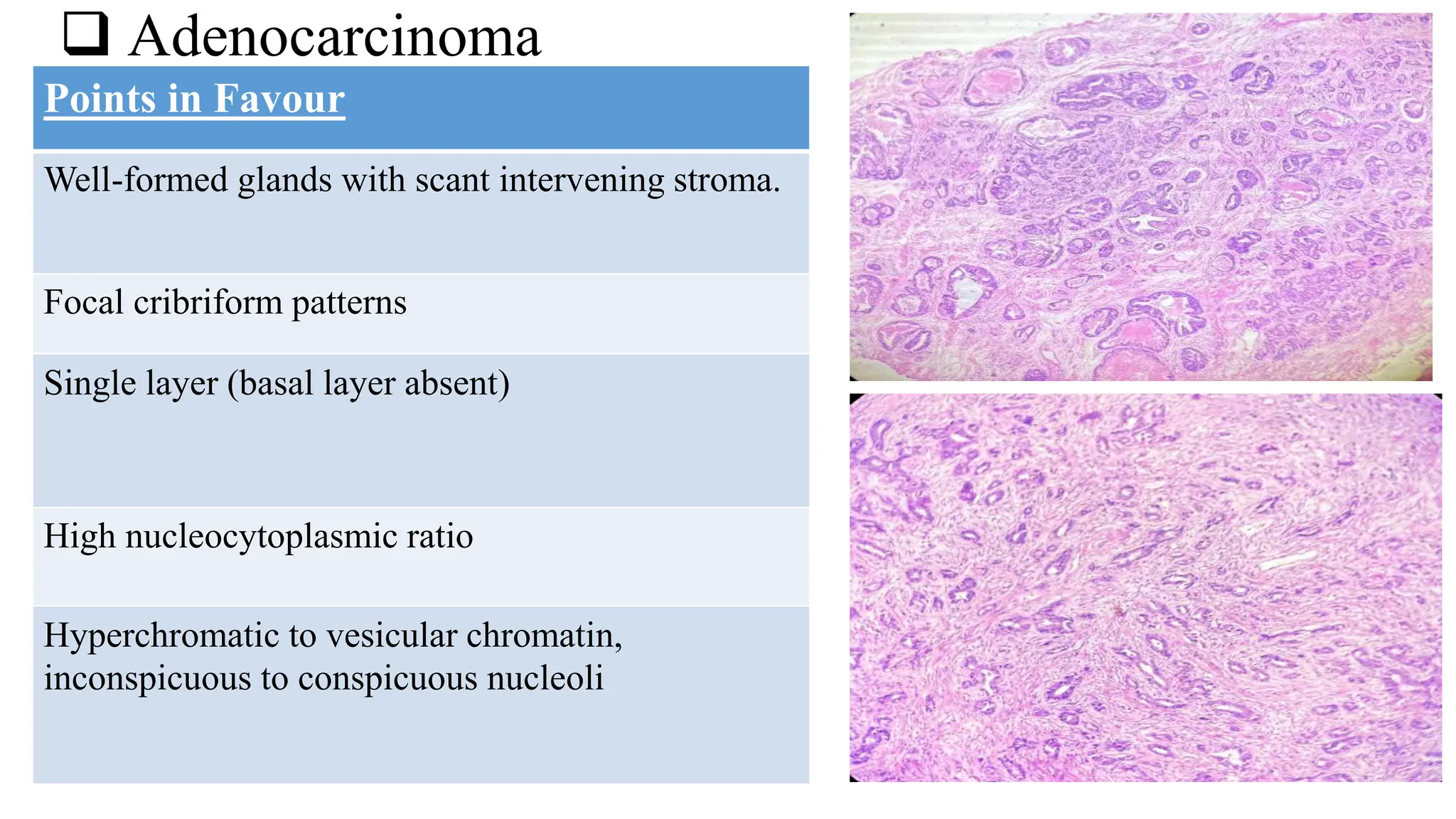 Ca Prostate Case discussion.presentation | PPTX