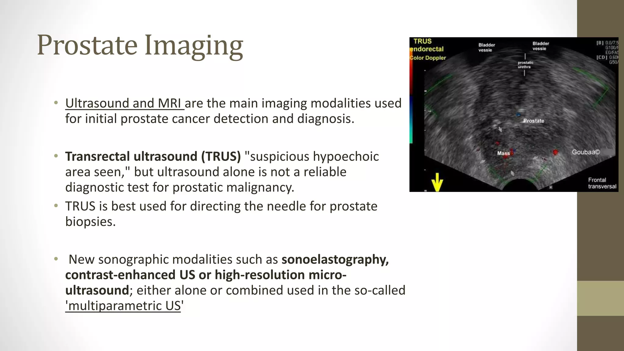 Carcinoma Of Prostate and its management | PPTX