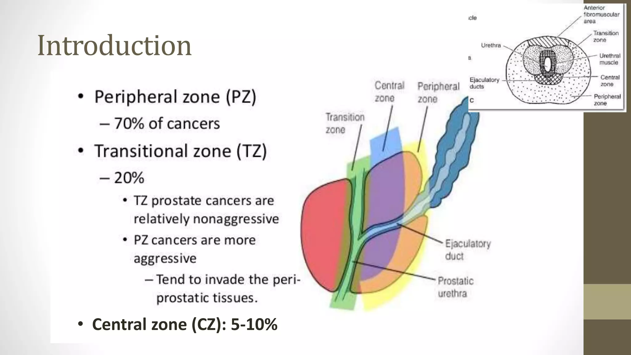 Carcinoma Of Prostate and its management | PPTX