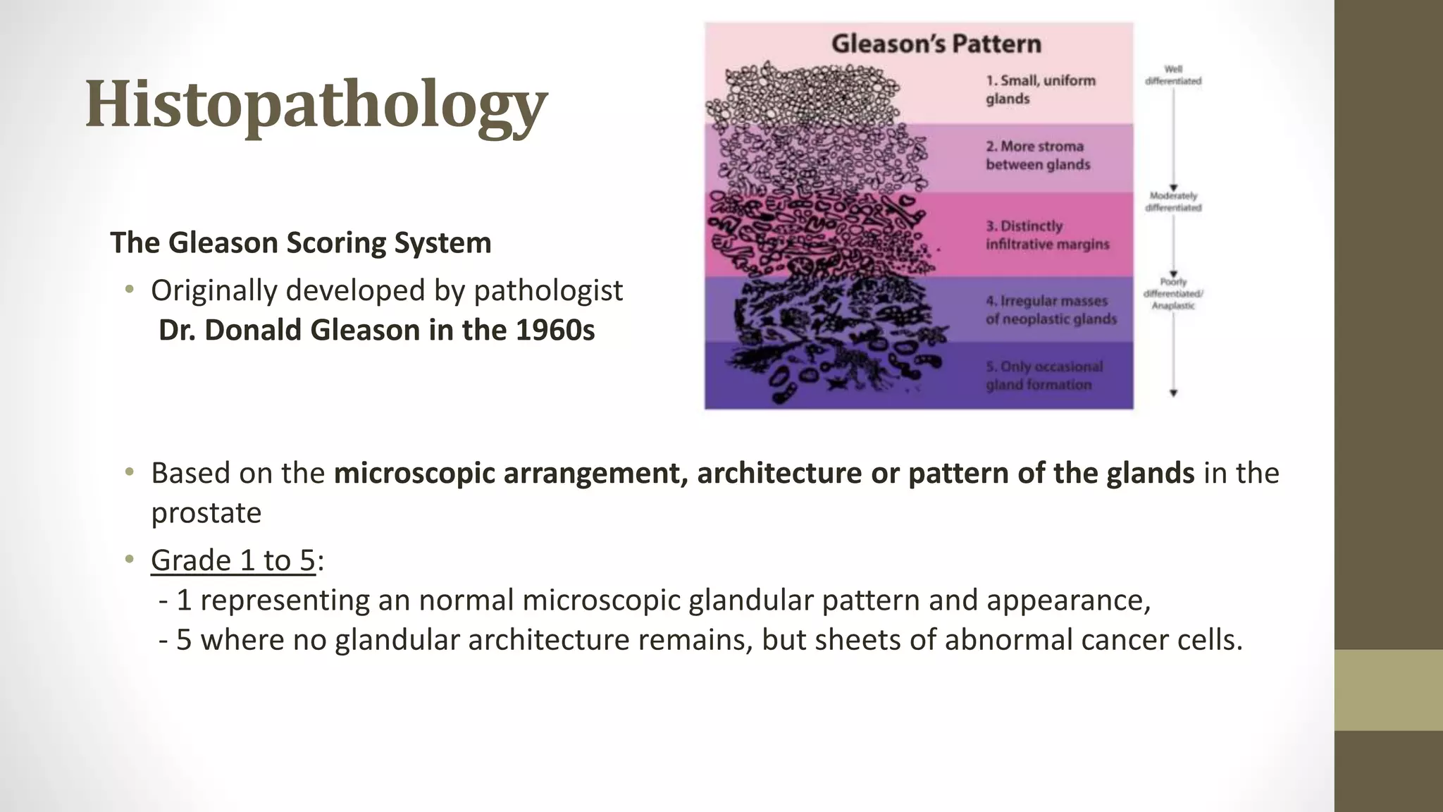 Carcinoma Of Prostate and its management | PPTX