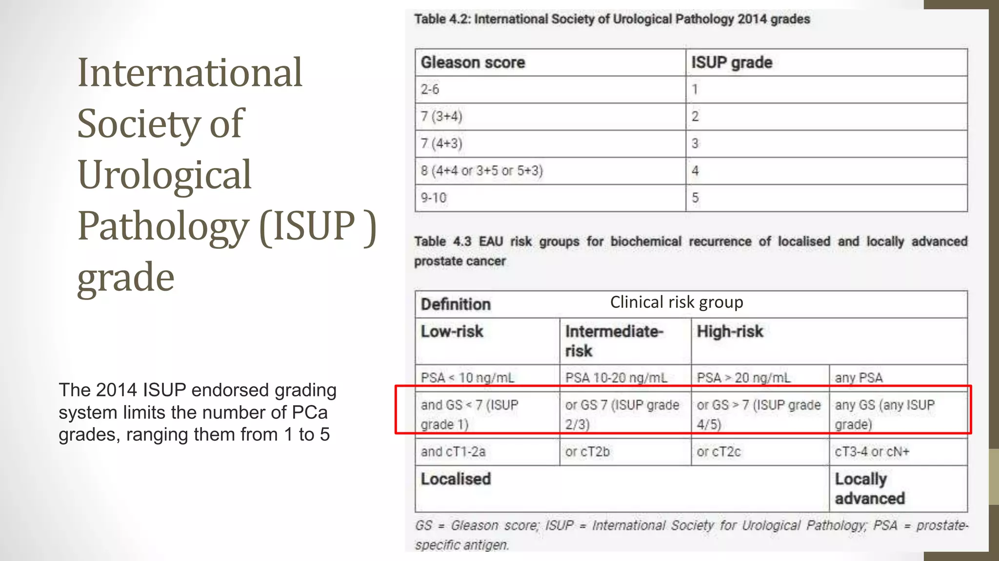 Carcinoma Of Prostate and its management | PPTX