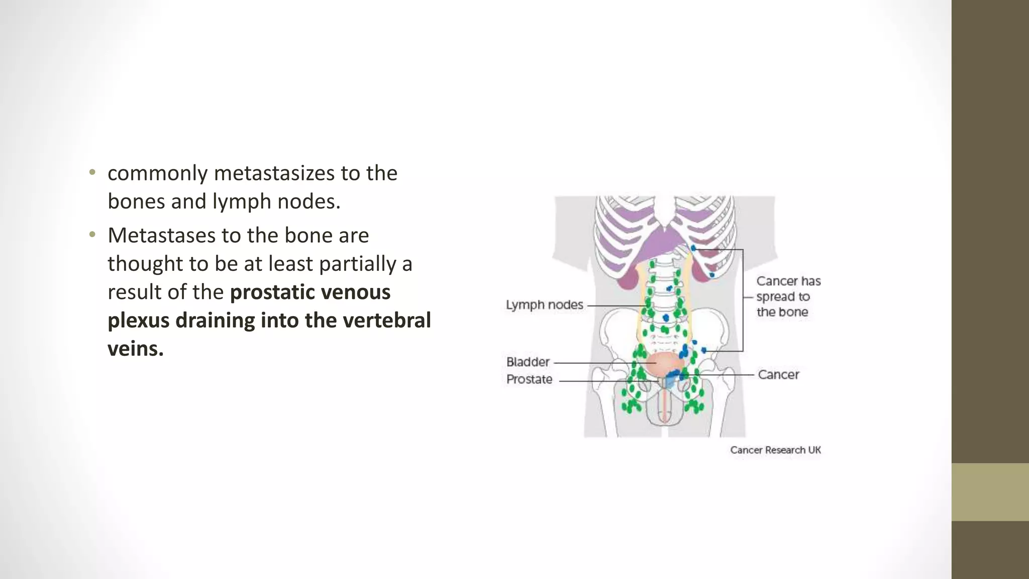 Carcinoma Of Prostate and its management | PPTX