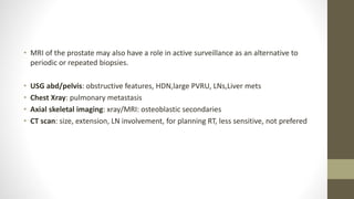 Carcinoma Of Prostate and its management | PPTX