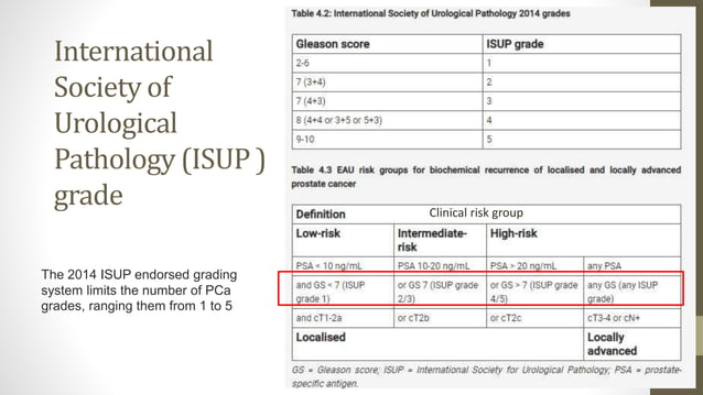 Carcinoma Of Prostate and its management | PPTX