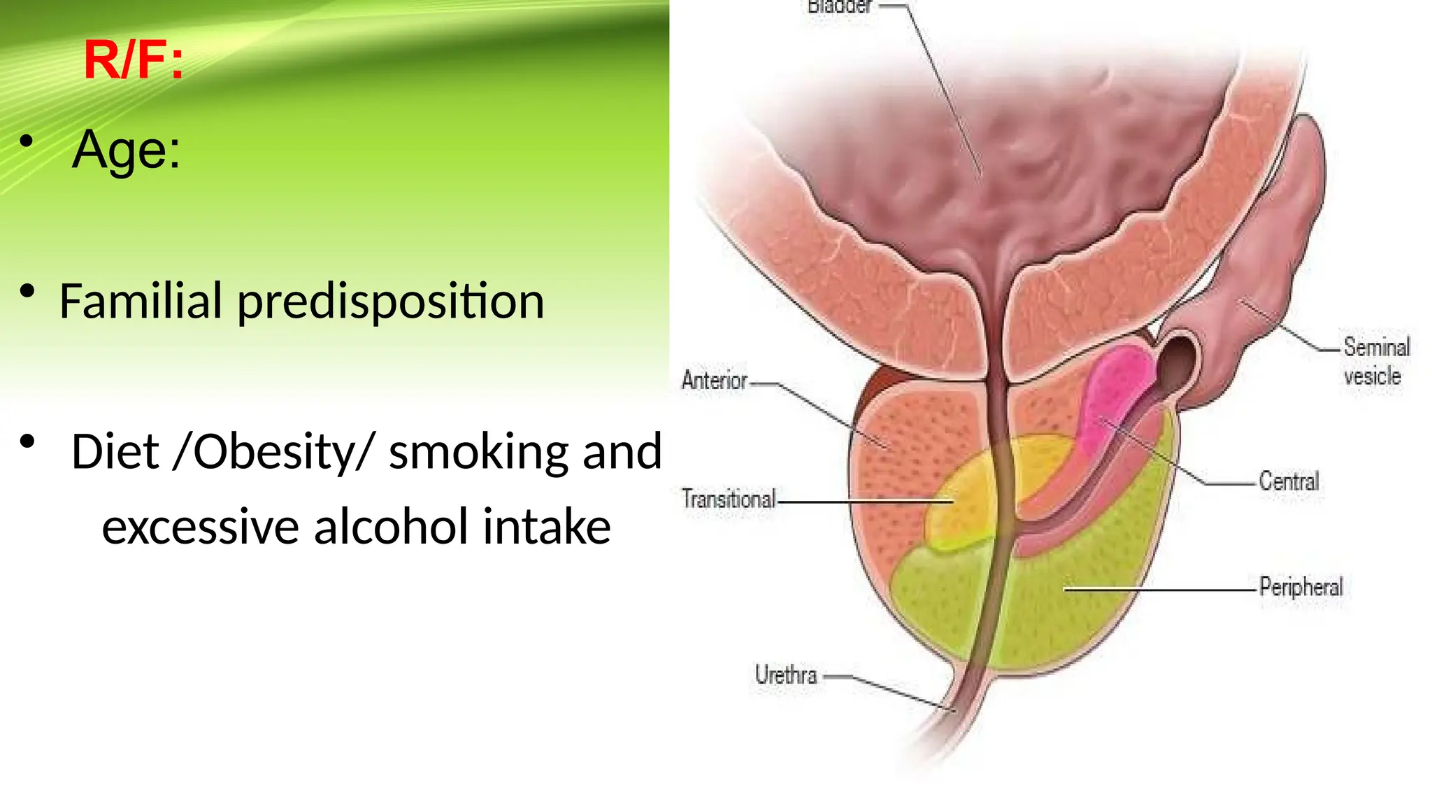 Ca Prostrate.medical surgical nursingpptx | PPT