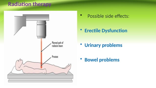 Ca Prostrate.medical surgical nursingpptx | PPTX