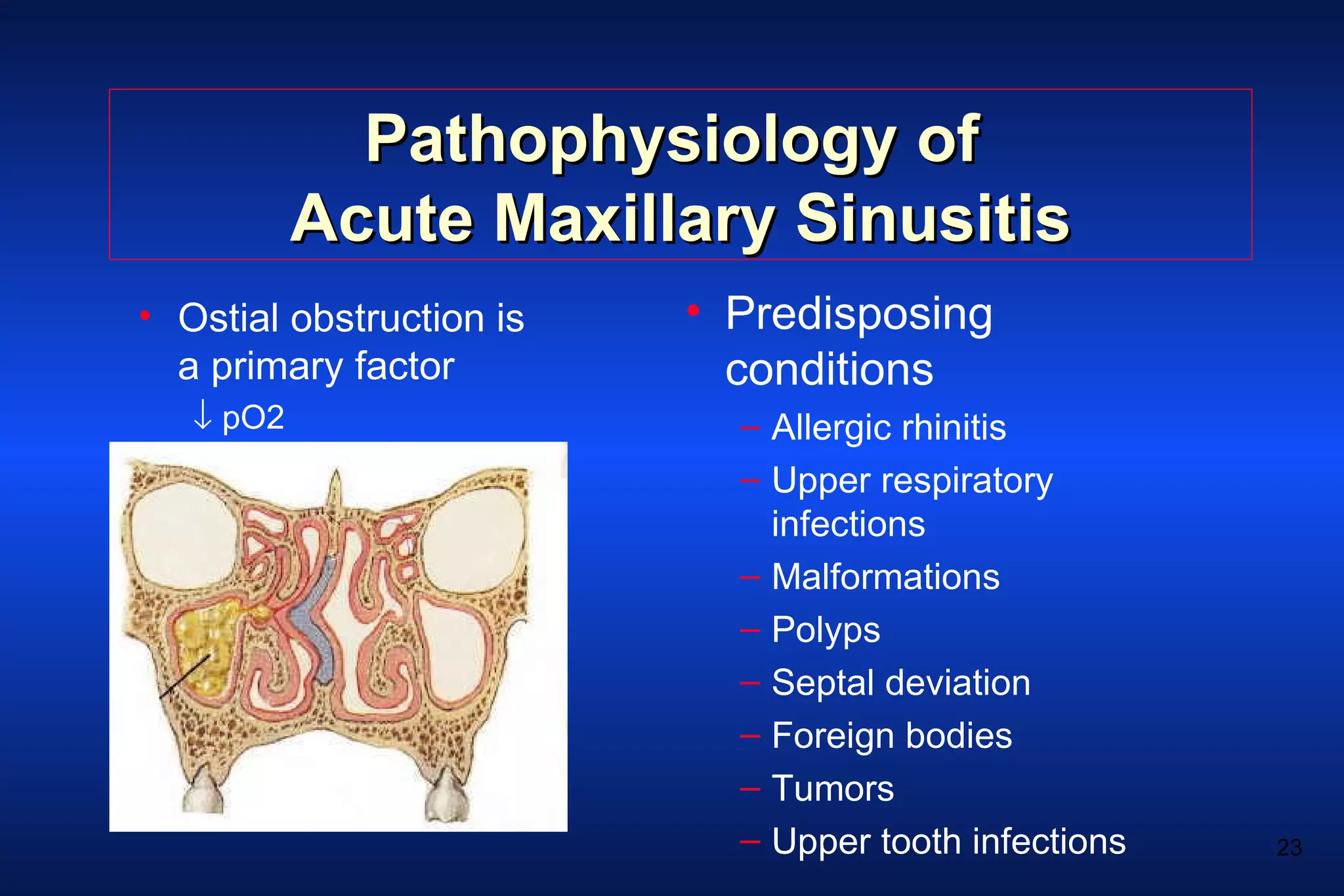 Cap Sinusitis Pharyngitis Im0306.Ppt