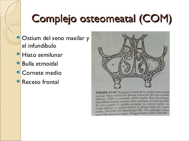 complejo osteomeatal