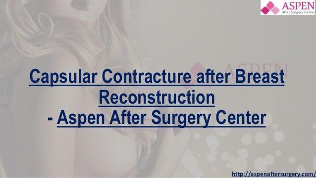 Capsular Contracture After Breast Reconstruction Pptx