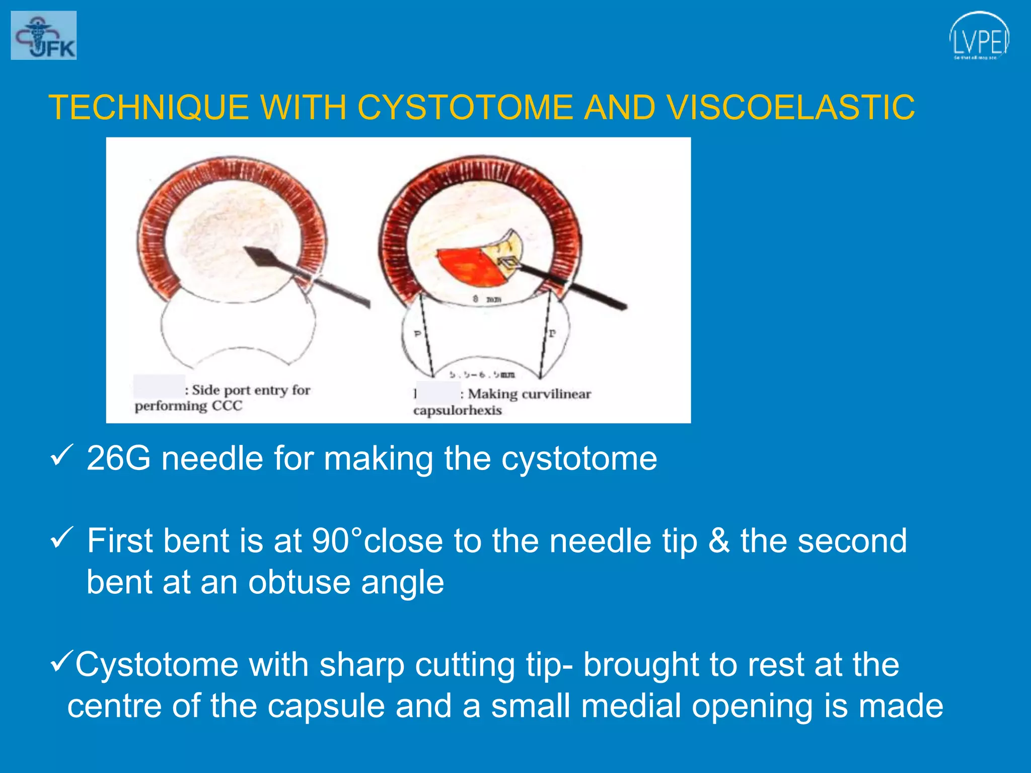 Capsular opening.pptx