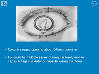 Capsular opening.pptx