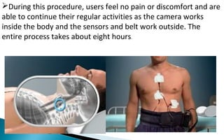 Capsule endoscopy | PPT