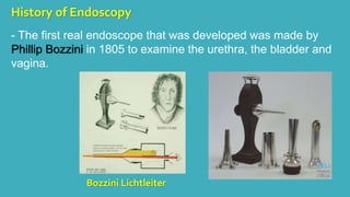 Capsule endoscopy | PPTX