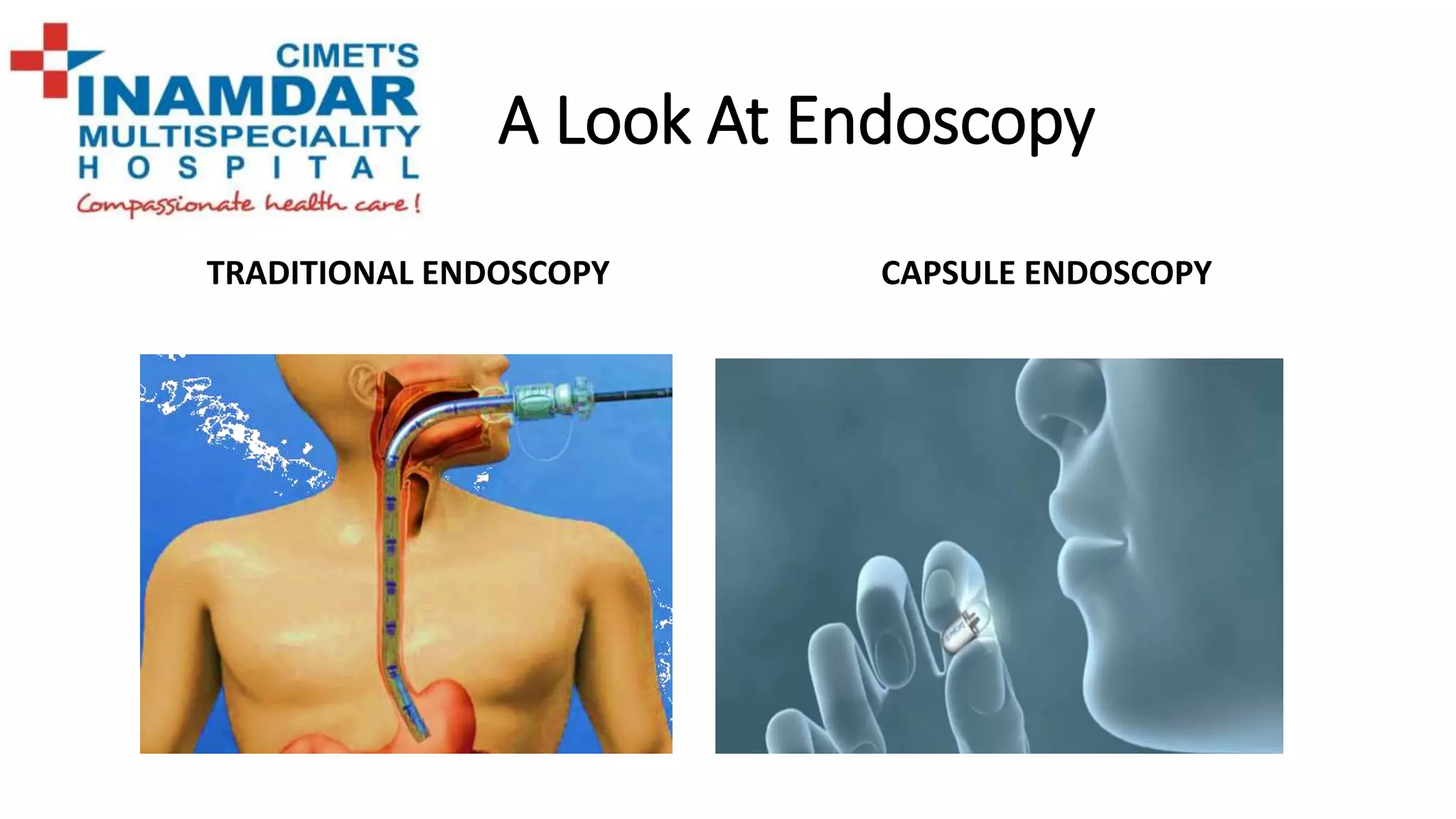 Capsule Endoscopy | PPT
