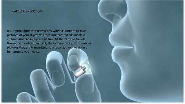 Capsule Endoscopy | PPT