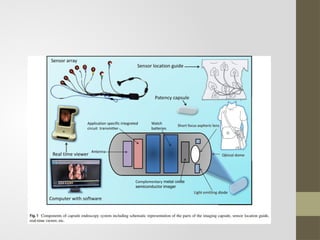 Capsule endoscopy of small bowel and it's diseases | PPTX