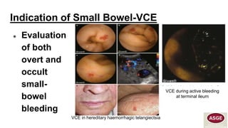 Capsule endoscopy_ A new dimension of endoscopy Final.pptx