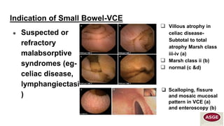 Capsule endoscopy_ A new dimension of endoscopy Final.pptx