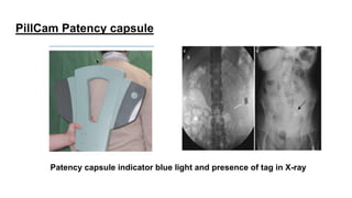 Capsule endoscopy_ A new dimension of endoscopy Final.pptx