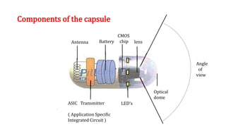 Capsule Endoscopy | PPT