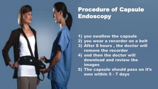 Capsule Endoscopy | PPT