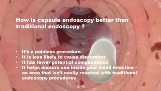 Capsule Endoscopy | PPT
