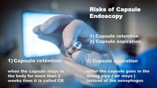 Capsule Endoscopy | PPT