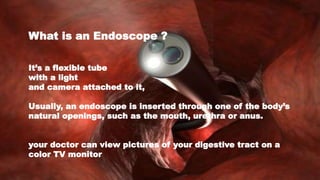 Capsule Endoscopy | PPTX
