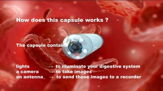 Capsule Endoscopy | PPT