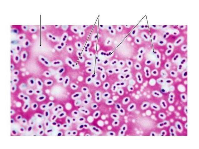 Capsule staining.pptx