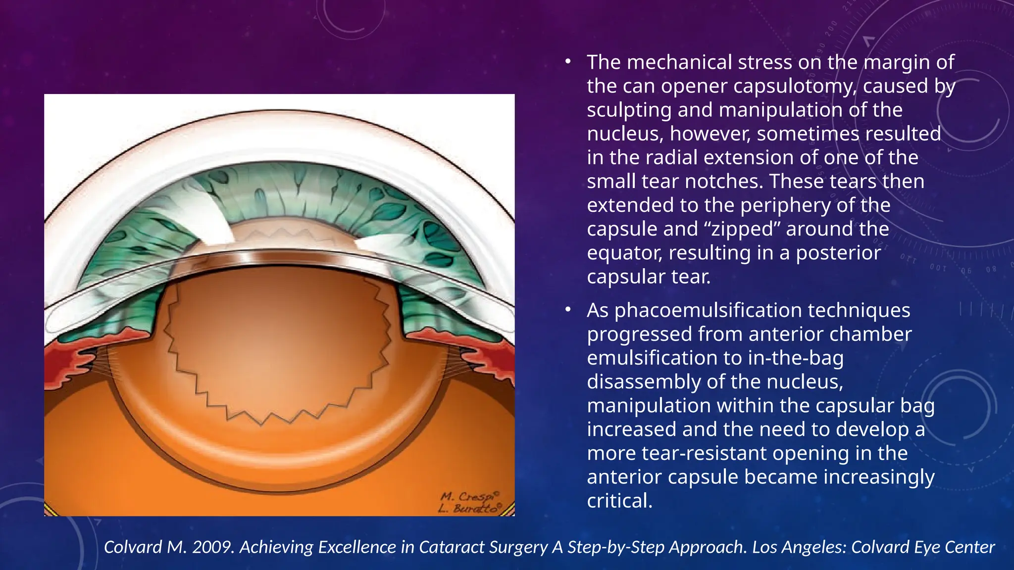Capsulorhexis (jenis dan tatacara) pada operasi katarak.pptx