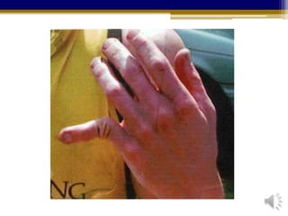 Emory University Flag Football Captain's Meeting PowerPoint | PPTX