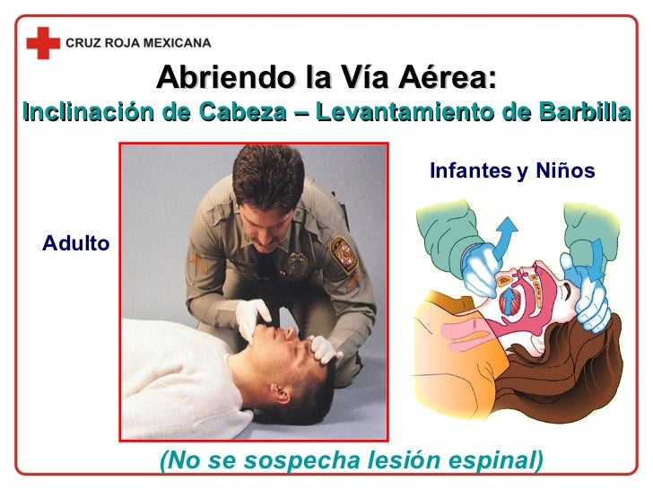 CapíTulo 07 Manejo BáSico De La VíA AéRea 2