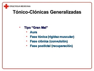 CapíTulo 29 Convulsiones Y Sincope | PPT