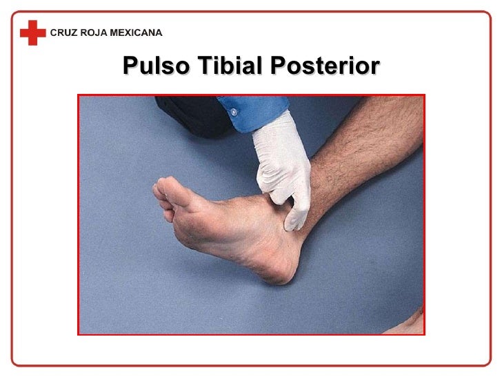 Pulso Tibial Posterior