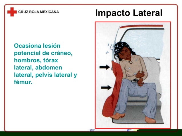 Capítulo 13 Mecanismos De Lesión | PPT