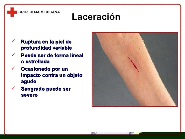 Capítulo 15 Lesiones De Tejidos Blandos