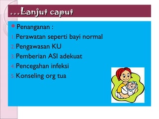 Caput Succedaneum materi askeb STIKES Muhammadiyah Kudus | PPT