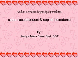 caput n cephal.ppt