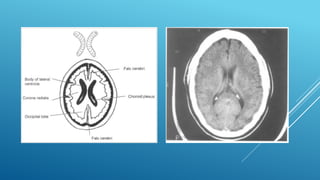-Cara-Membaca-Ct-scan-Kepala terbaik.pptx