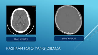 -Cara-Membaca-Ct-scan-Kepala terbaik.pptx