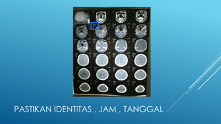 -Cara-Membaca-Ct-scan-Kepala terbaik.pptx
