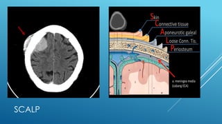 -Cara-Membaca-Ct-scan-Kepala terbaik.pptx