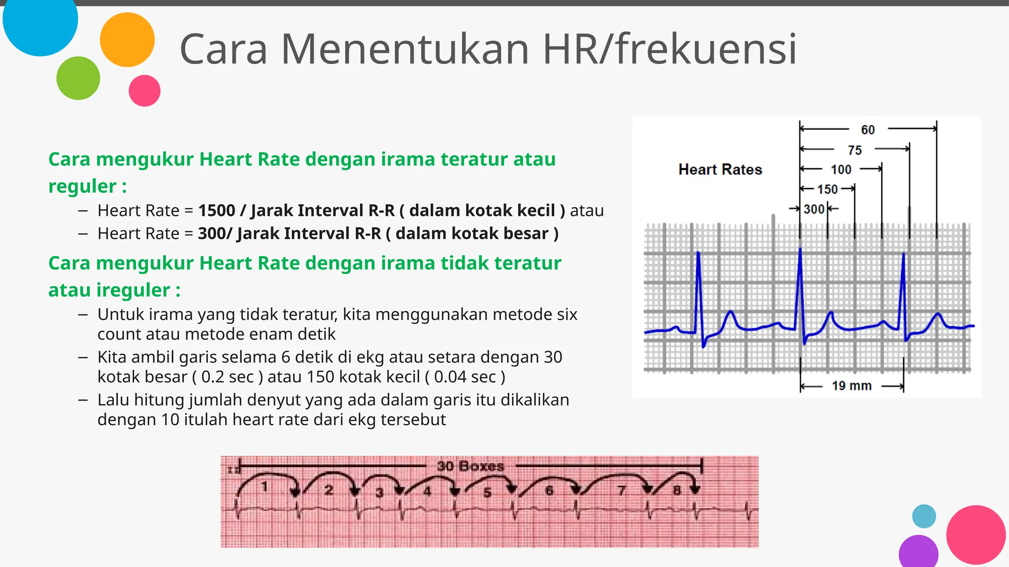 Cara baca EKG yang mudah untuk pemula perawat | PPTX