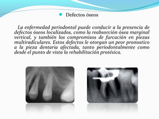 Caracterisitcas pilar disminuido periodontalmente | PPT