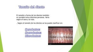 CARACTERÍSTICAS GENERALES DE LOS DIENTES: COLOR Y TAMAÑO PPT | PPTX