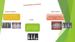 CARACTERÍSTICAS GENERALES DE LOS DIENTES: COLOR Y TAMAÑO PPT | PPTX