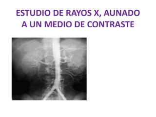 Caracteristicas basicas de los aparatos de rayos x | PPTX