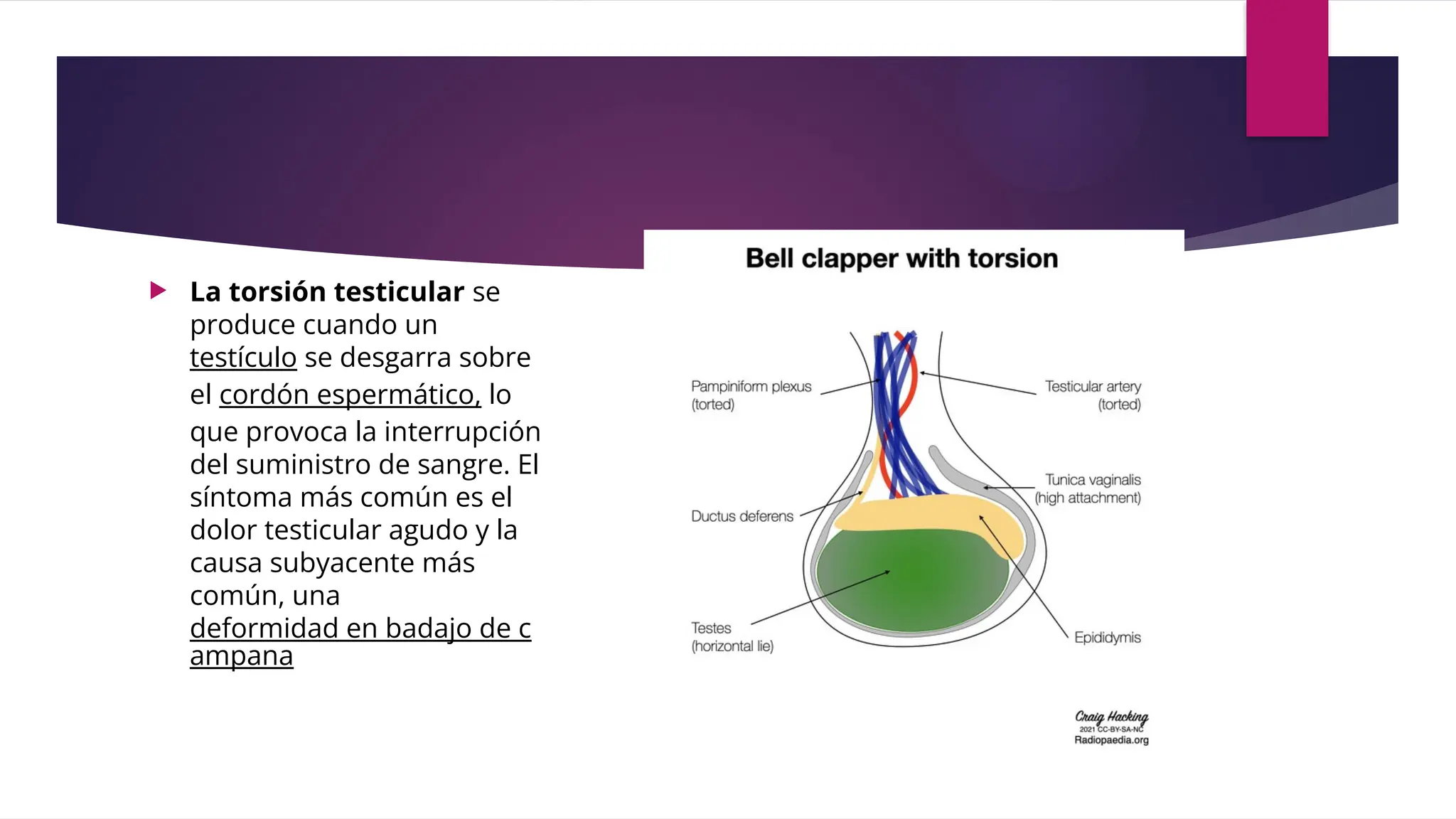 caracteristicas radiologicas escroto agudo.pptx