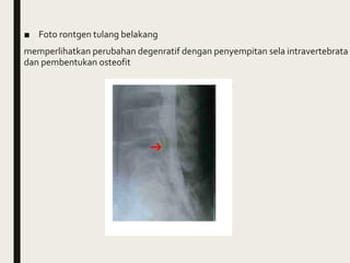 Cara Mediagnosa HNP.pptx